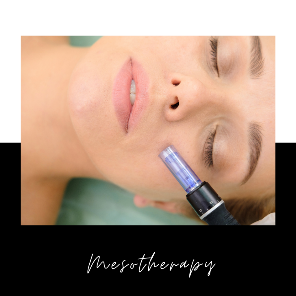 Mesotherapy - Everything You Need To Know