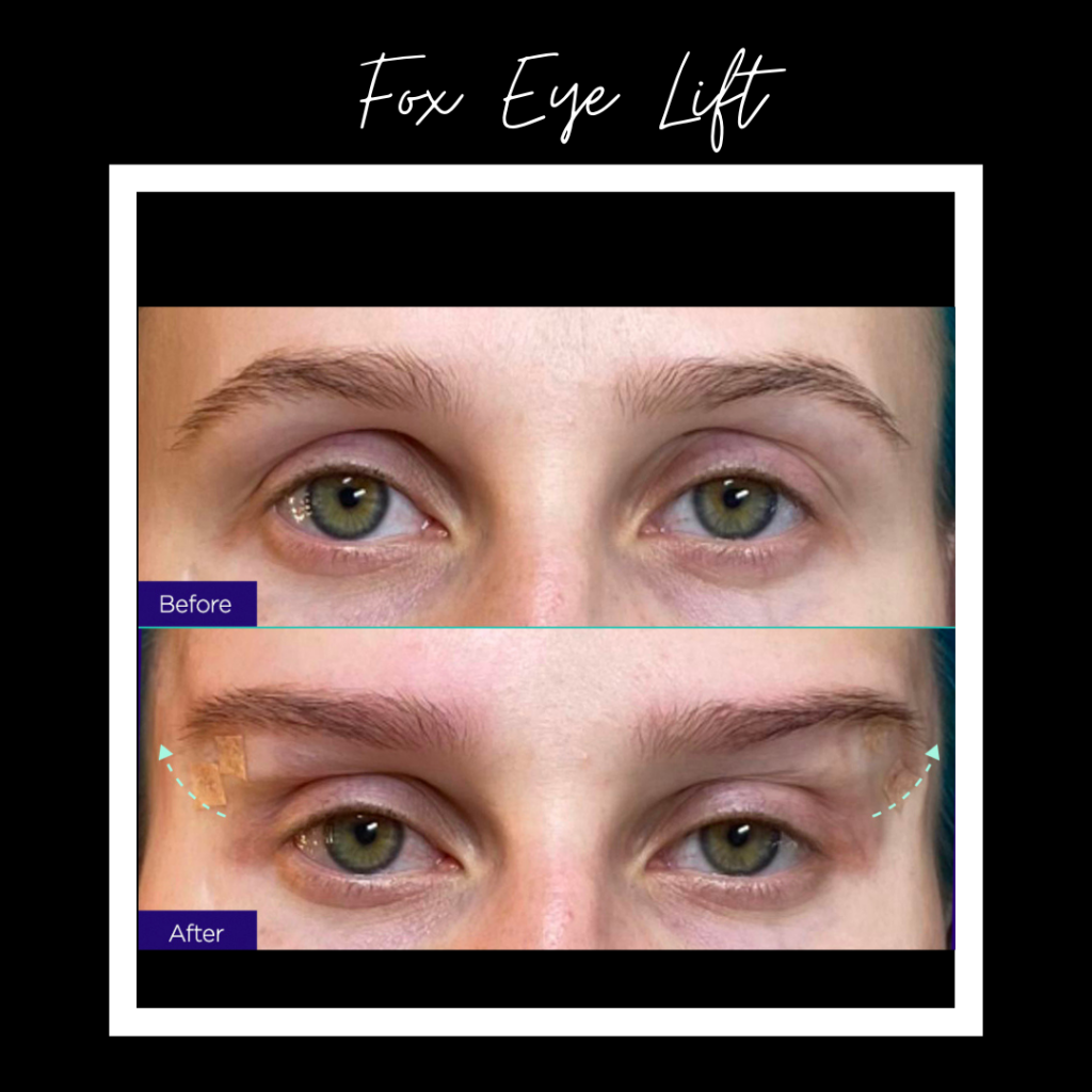 Fox Eyes - The trend that was always here, click to find out why!